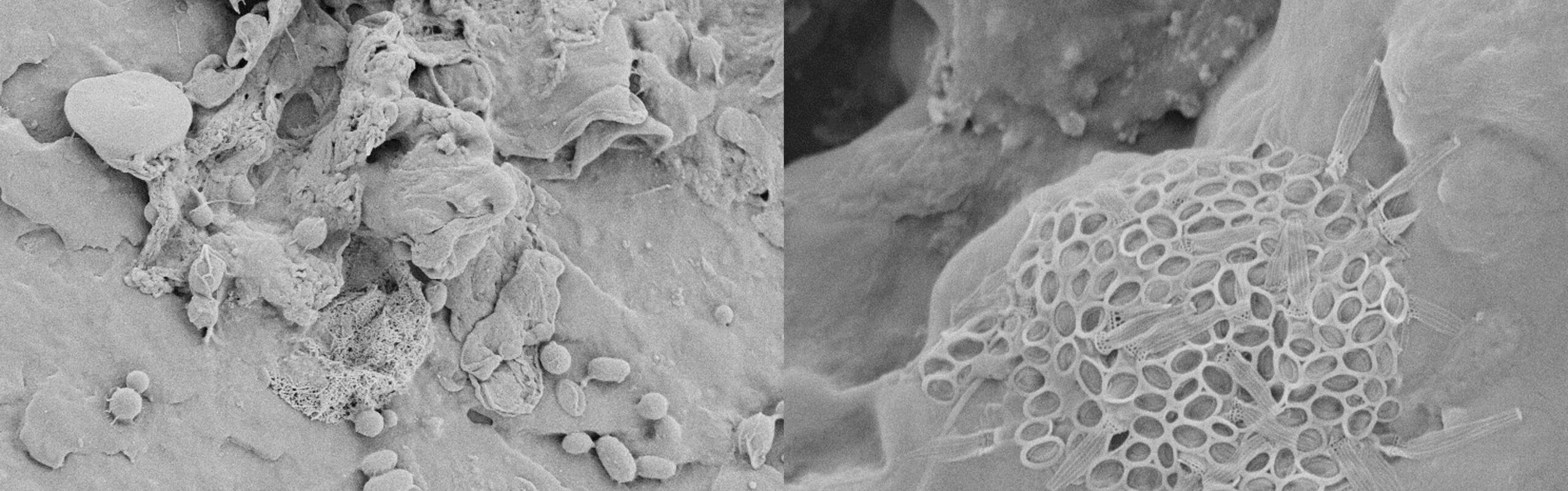 Microplastics and biofilms - Wasser 3.0