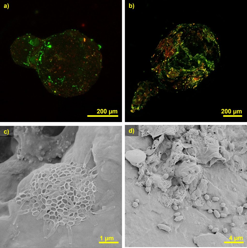 Microplastics and biofilms - Wasser 3.0