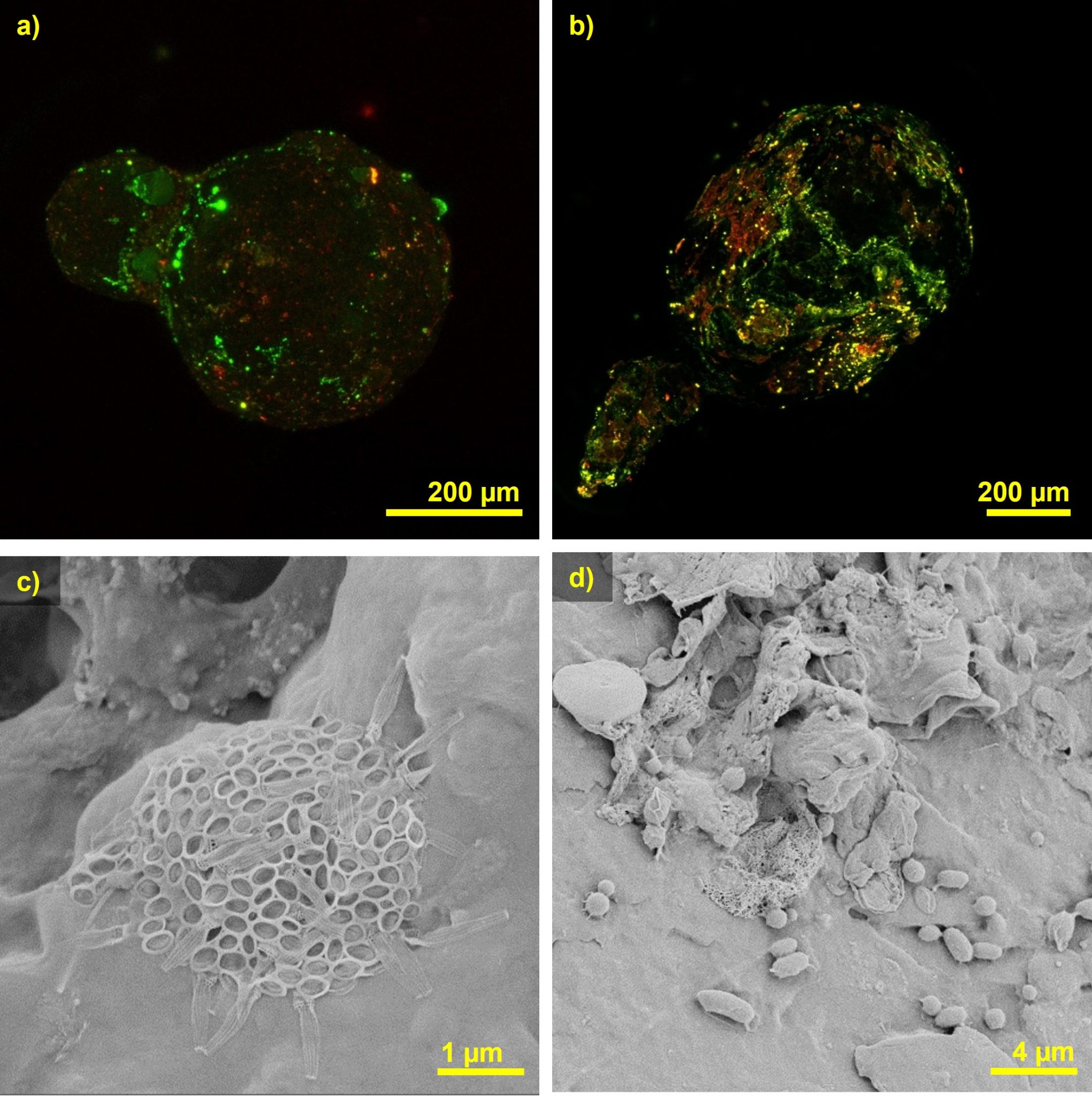 Microplastics and biofilms - Wasser 3.0